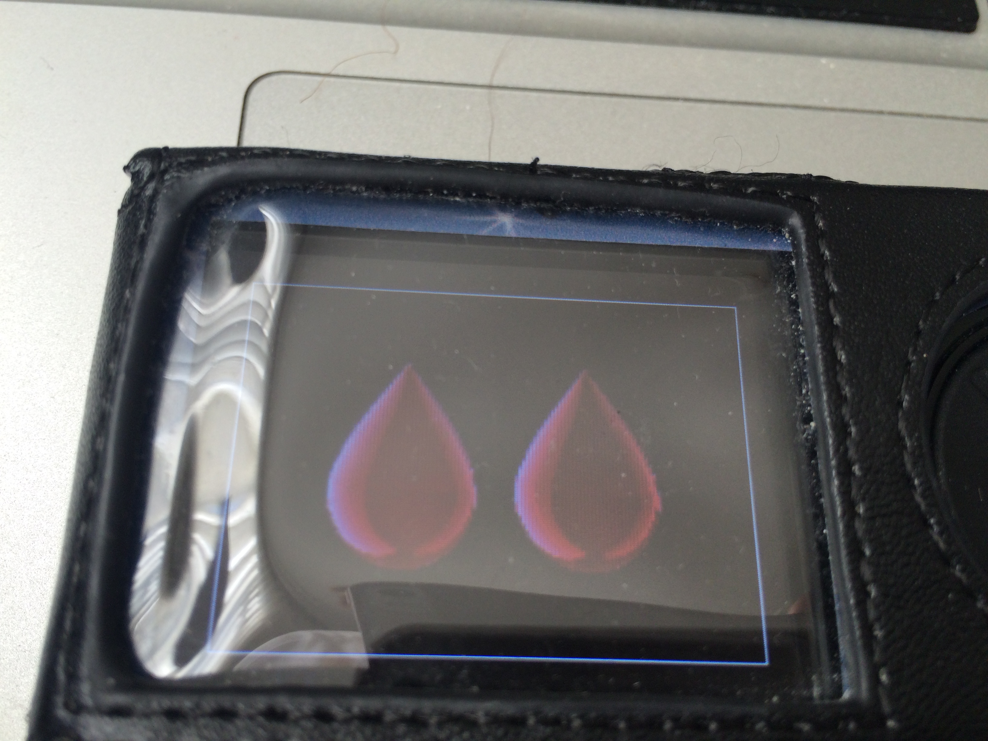 Dexcom 4 | Diyabetimben.com