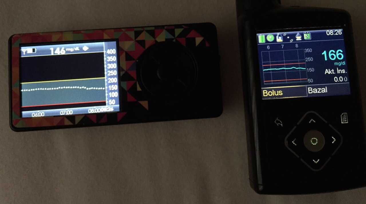 Medtronic 640G Tecrübelerim | Diyabetimben.com